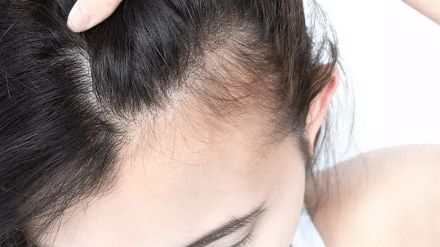 How to Identify Signs of New Hair Growth on Scalp - Stemsontx
